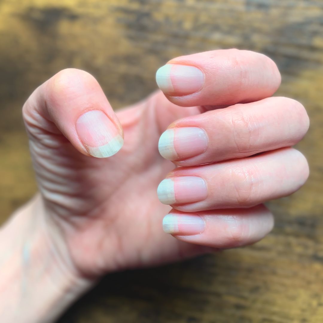 【自爪の育成日記】ハイポニキウムを伸ばす・爪を縦長にする方法＜1＞ | Rhythm Slow｜リズムスロー