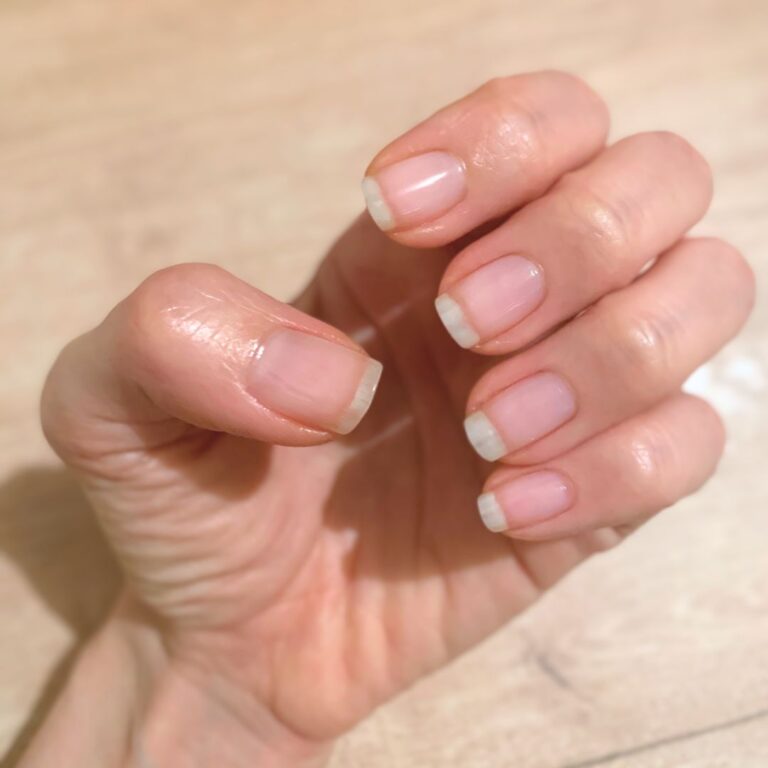 【自爪の育成日記】ハイポニキウムを伸ばす・爪を縦長にする方法＜1＞ | Rhythm Slow｜リズムスロー