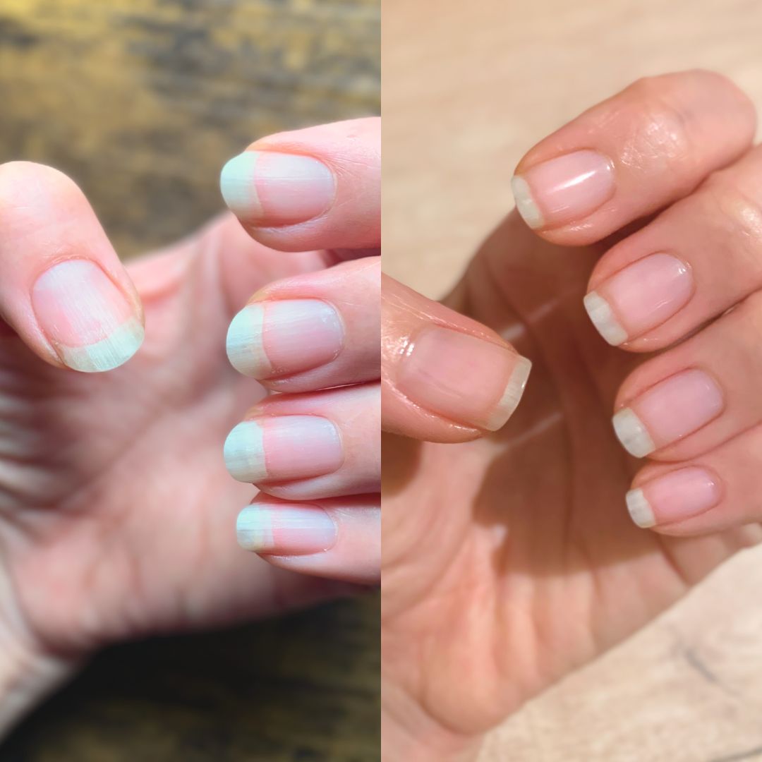 【自爪の育成日記】ハイポニキウムを伸ばす・爪を縦長にする方法＜1＞ | Rhythm Slow｜リズムスロー